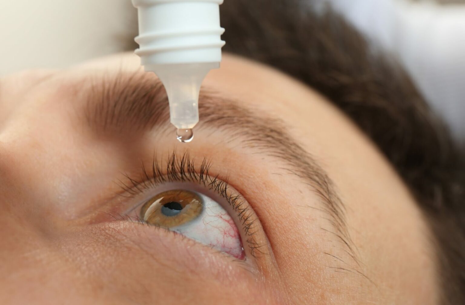 Can a Common Cold Affect Your Eyes? | Calgary